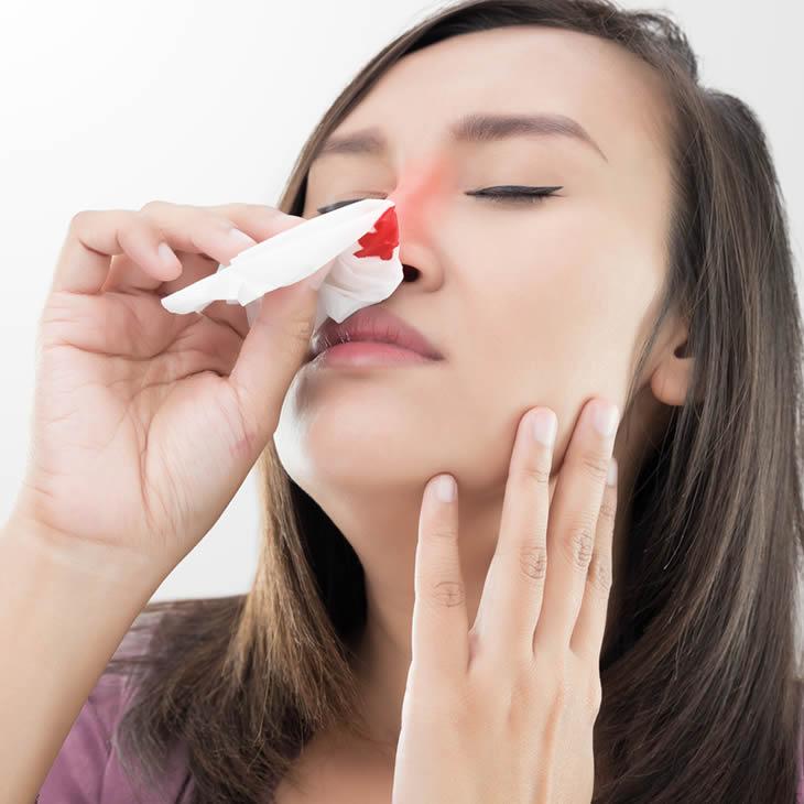 Nosebleeds | Pacific ENT Advanced Treatments | Carlsbad, CA 92011